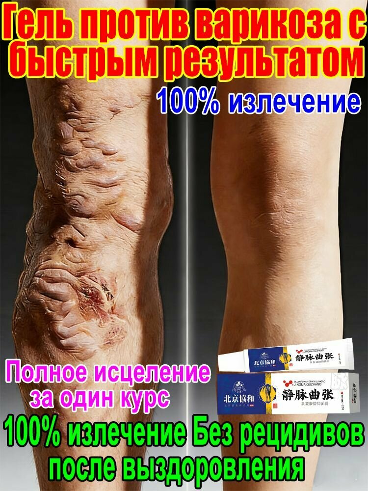 Крем от варикоза, отеков и тяжести в ногах для улучшения кровообращения, лечения сосудов и снятия усталости, 20 г