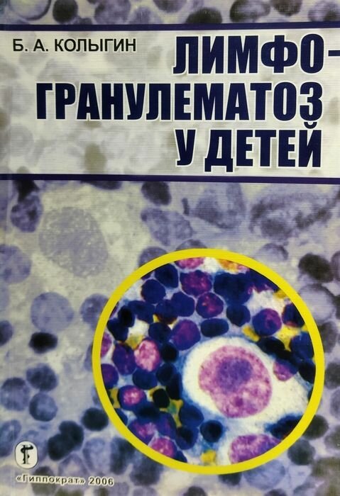 Лимфогранулематоз у детей