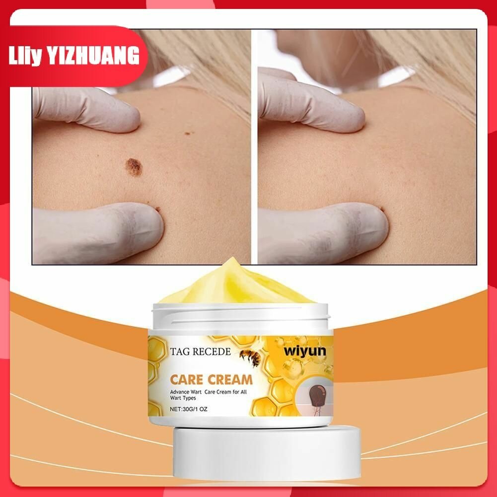 Пчелиный яд Средство от папиллом и бородавок, мазь для ухода за кожей, крем от родинок, папиллом и бородавок