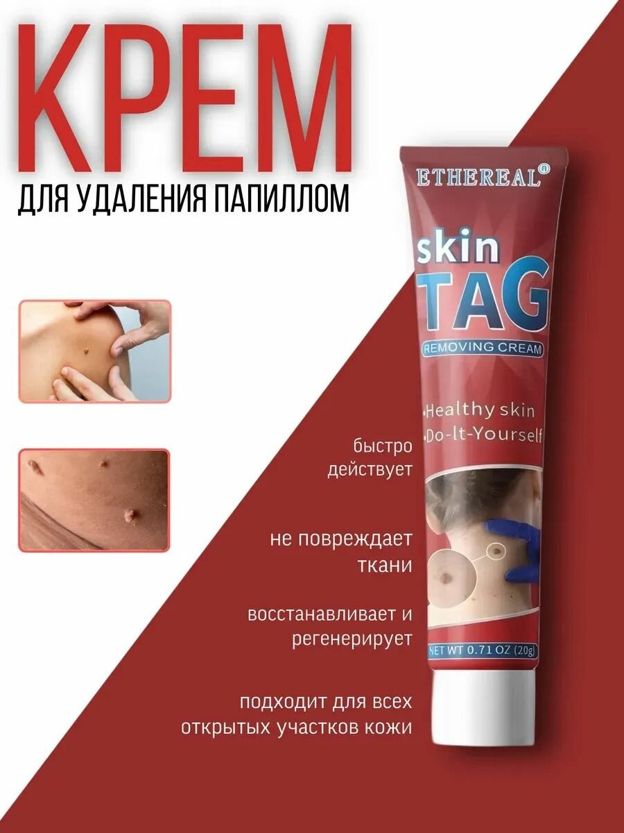 Крем малавтилин от папиллом