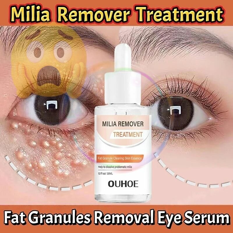 Сыворотка для удаления жировых частиц вокруг глаз, восстанавливающее средство для век "просо", подтяжка морщин, увлажнение и борьба с отечностью, корейский уход за кожей