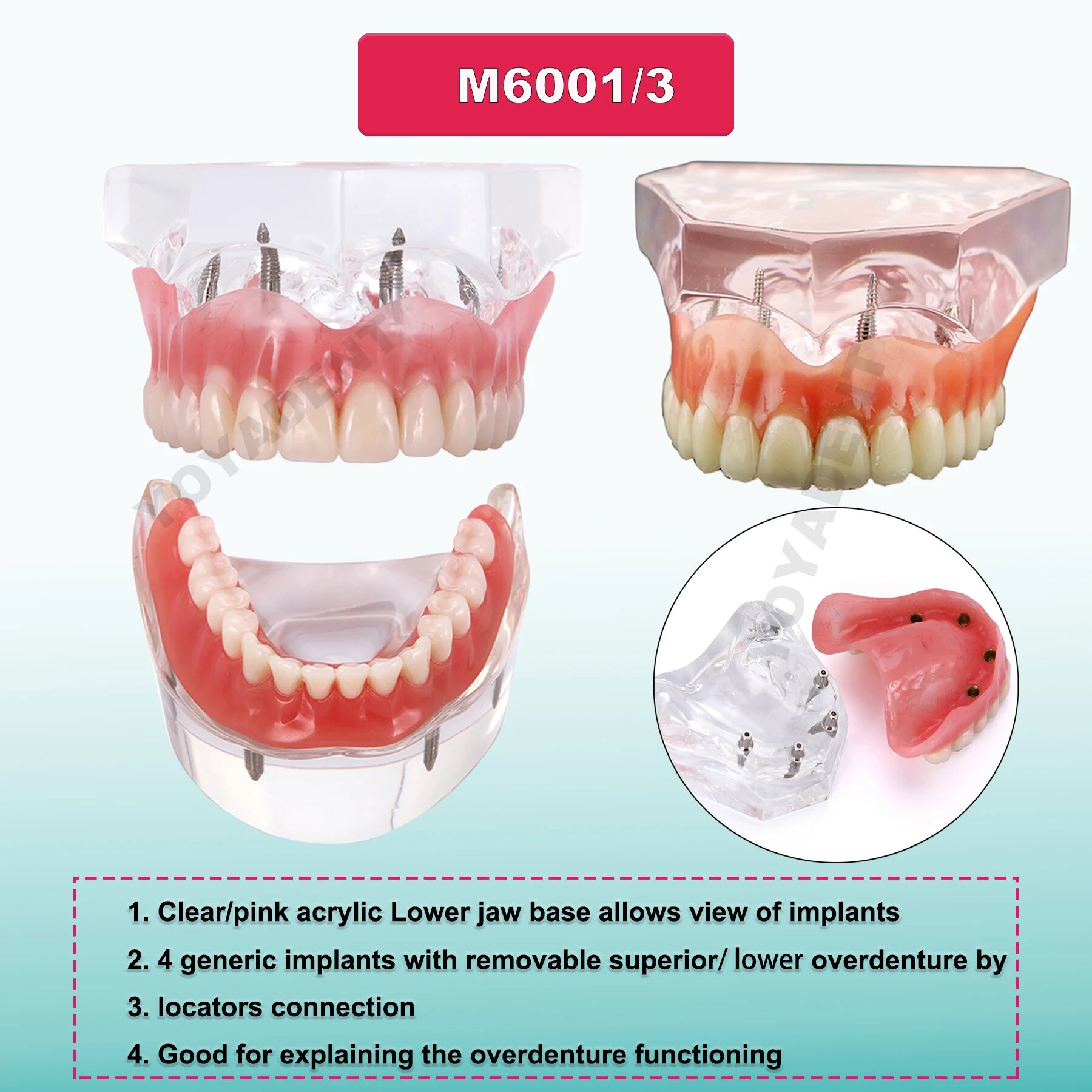 Стоматологические модели YOYADENT teeth model — фото 1
