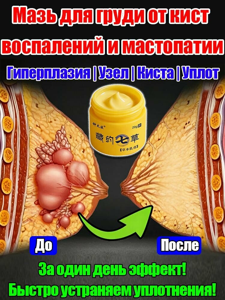 Мазь для груди при мастопатии, кистах и воспалениях