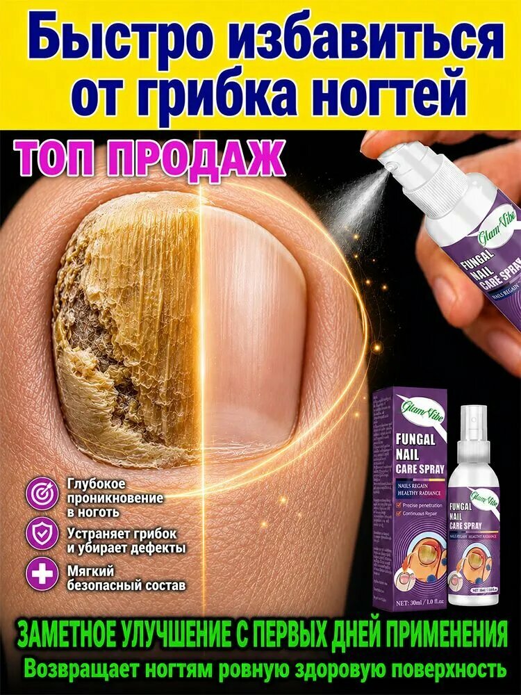 Лечебный спрей от грибка, эффективен при лечении грибковых инфекций и шелушении ногтей, устраняет неприятный запах и зуд, улучшает внешний вид поврежденных ногтей, мягкие ингредиенты, 30 мл.