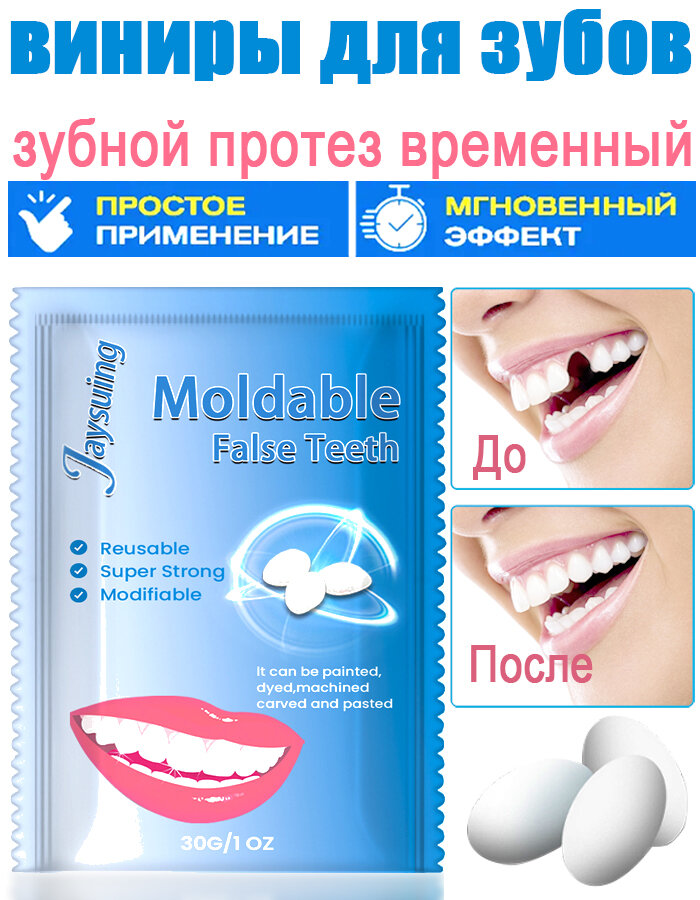 Виниры，зубы временные，челюсть стоматологическая вставная 30r
