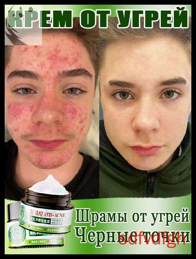 Салициловая мазь от прыщей, эффективно борется с воспалениями, направленная на акне и угри, прыщами и последствиями акне, подходит подросткам и проблемной коже, 30 г.