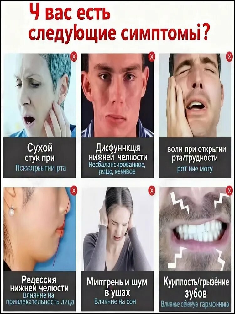 Капа, трейнер — фото 1