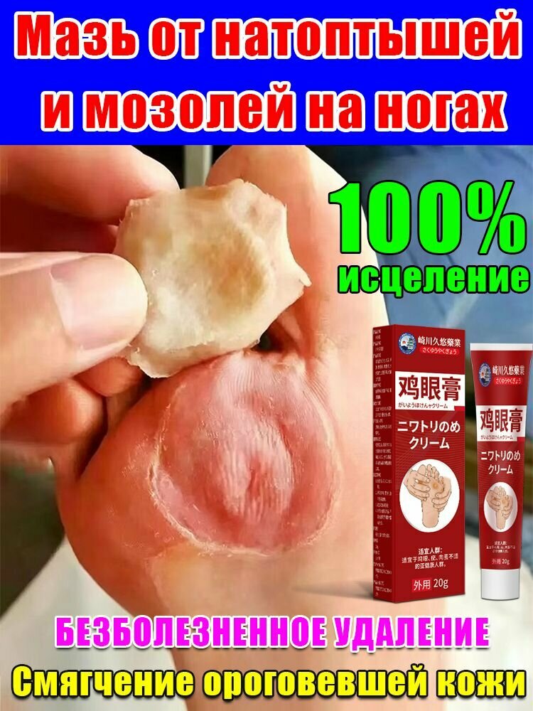 Мазь от стержневых мозолей на ногах смягчение и уход