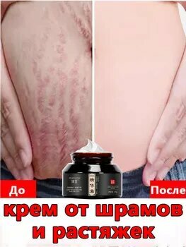 Крем для удаления шрамов 50 г от растяжек для осветления шрамов пятен от акне травм ожогов и мелких морщин