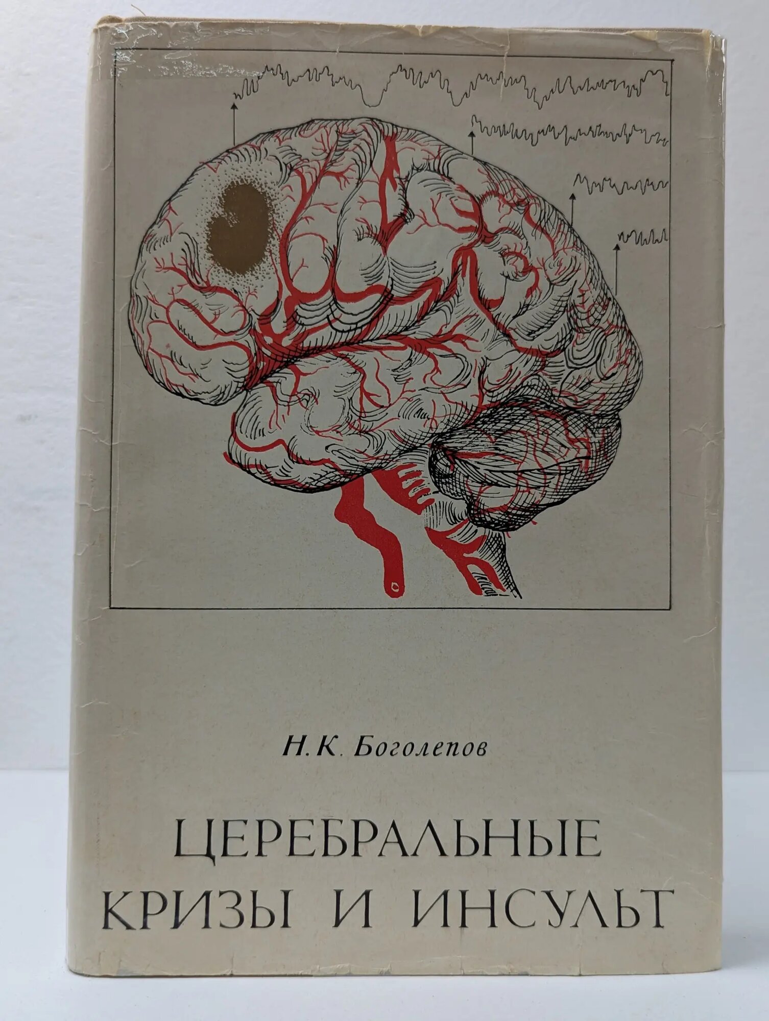 Церебральные кризы и инсульт Боголепов Николай Кириллович 1971