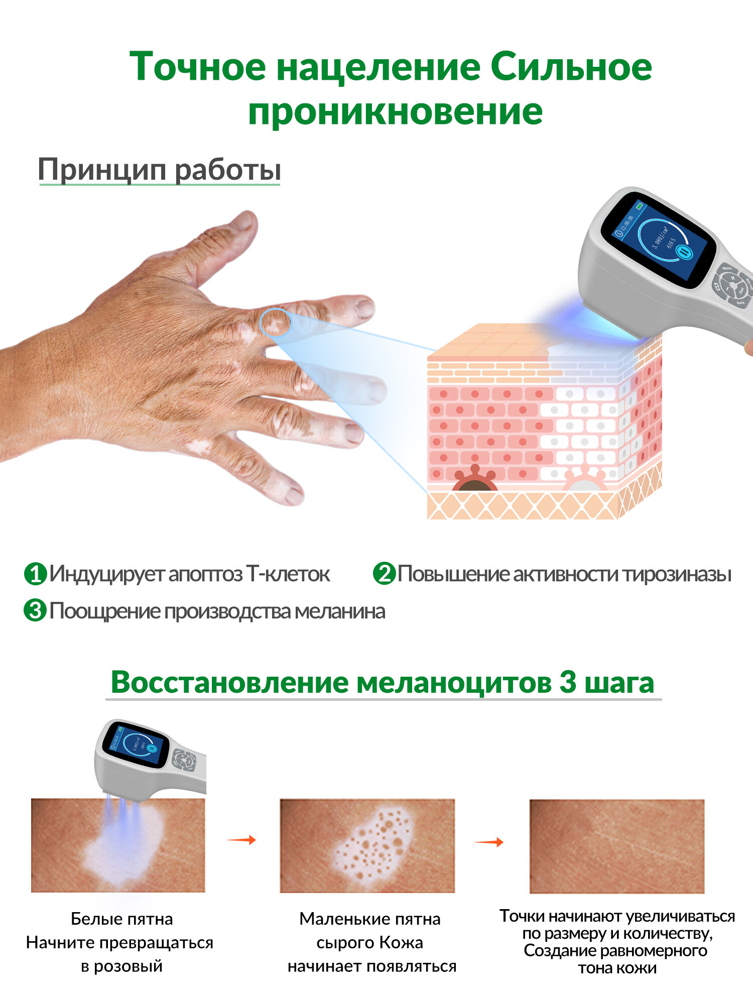 Frovab 308нм фототерапевтическое устройство, 49 диода, для лечения витилиго, псориаза, экземы и кожных заболеваний дома