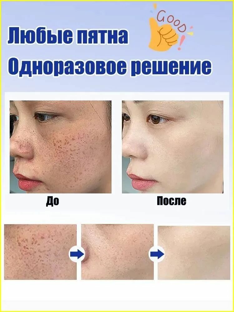 Крем от пигментных пятен на лице AofuXue 30