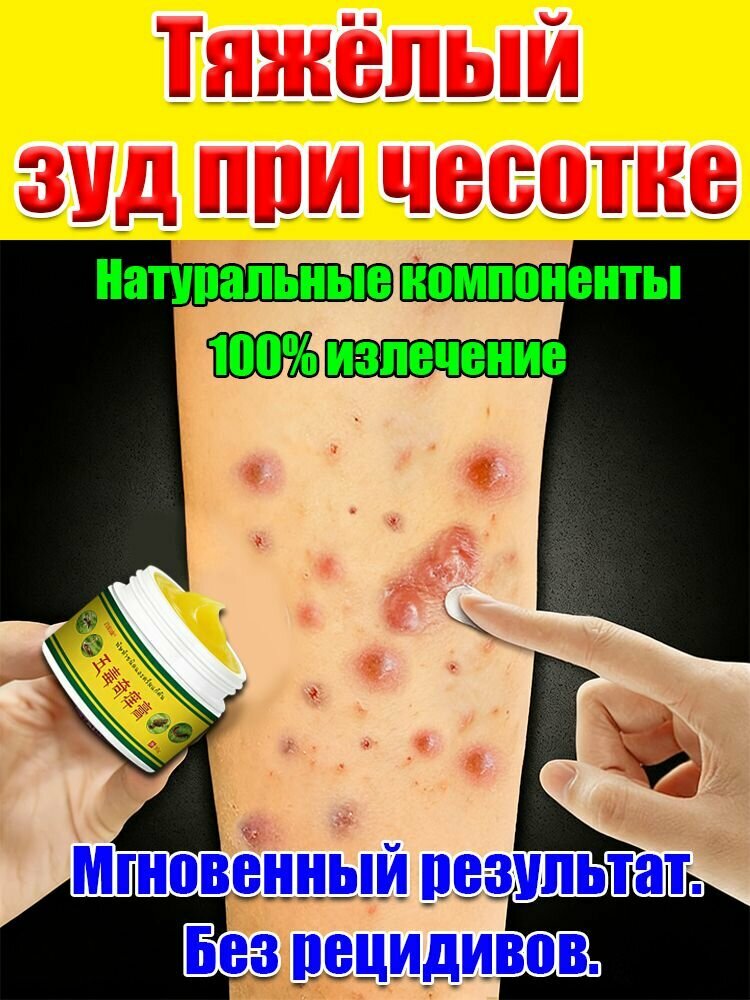 Мазь от укусов постельных клопов и комаров