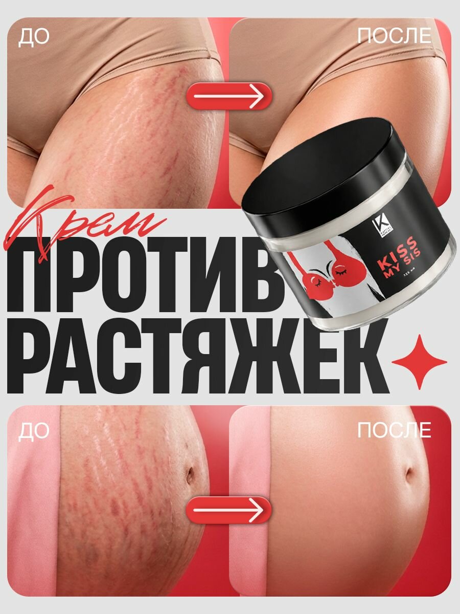 Крем от растяжек для беременных Kiss my Sis / Крем от растяжек для подростков, для упругости кожи, от целлюлита / 225 мл для беременных и подростков от растяжек и целлюлита
