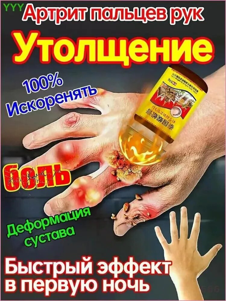 Мазь от подагры, Устранение боли при артрите, коленях, пальцах ног и т. д, на ноге и для рук и артрита 55 г Обновлять