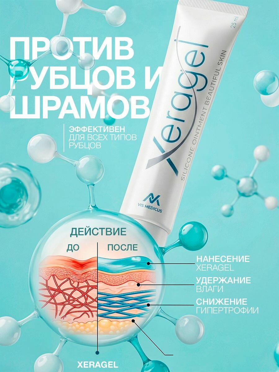 Гель от шрамов и рубцов Xeragel / Крем от растяжек, крем от растяжек, от ожогов, на силиконовой основе / 25 ml