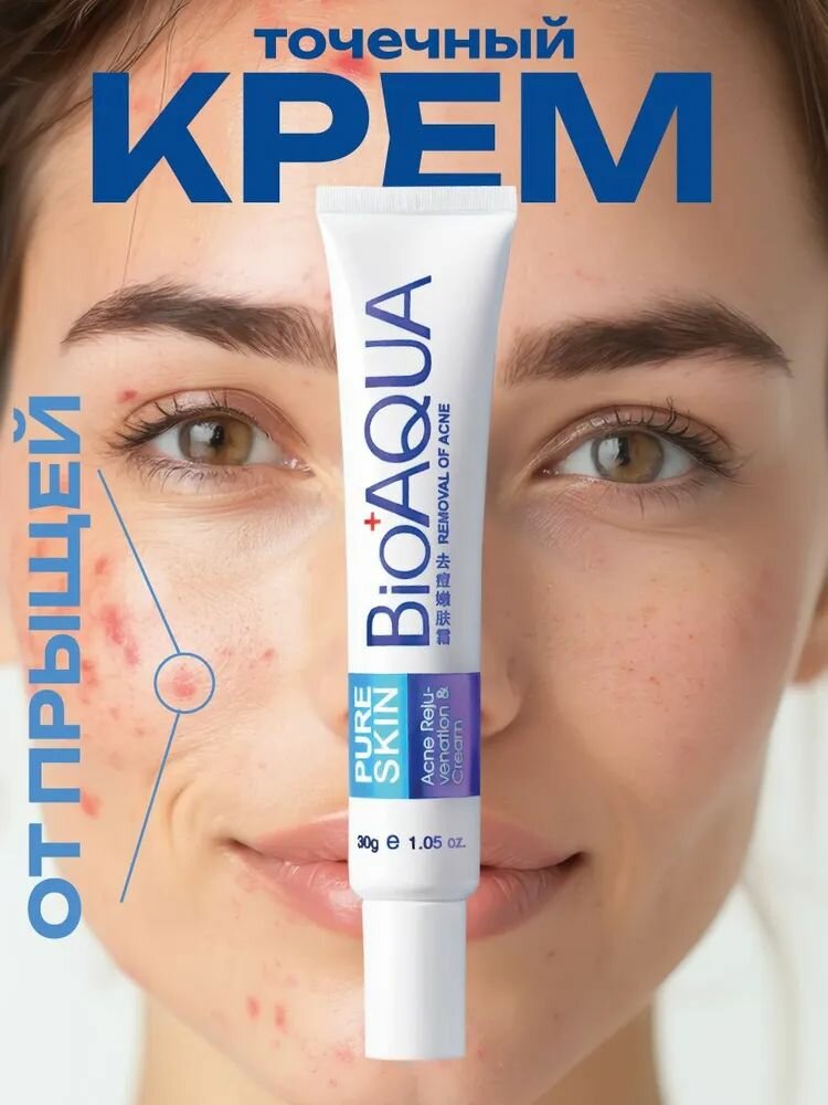 Крем от прыщей акне и черных точек BIOAQUA концентрированный, точечного действия, 30мл