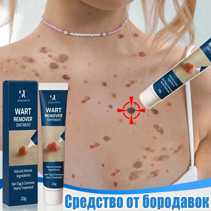 Крем для ухода за кожей SUSUVETA 20г от папиллом и бородавок для лица, шеи, тела и рук