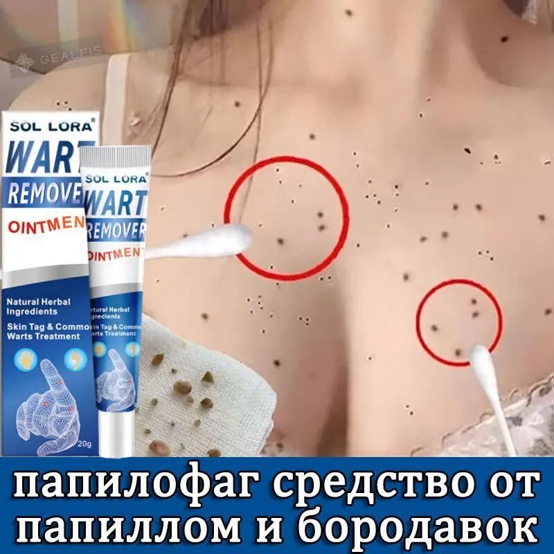 Лечение папиллом и бородавок на ороговевшей коже 20 грамм Крем для лица