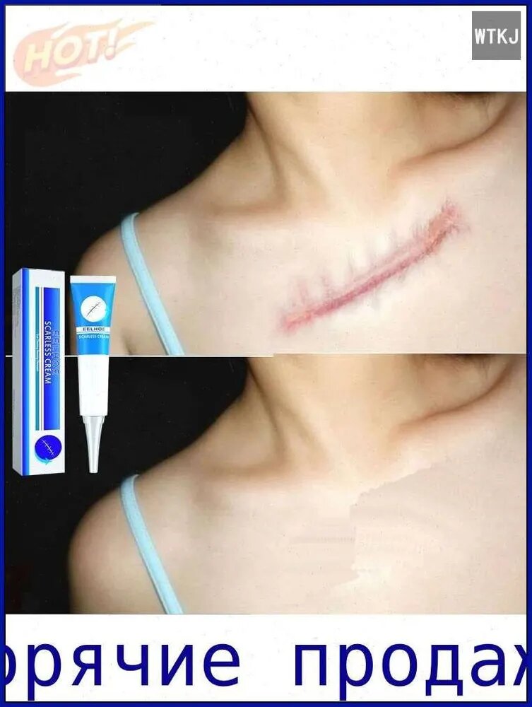 Крем Контрактубекс для восстановления кожи: эффективное средство от шрамов, растяжек и ожогов, нежный уход за кожей.