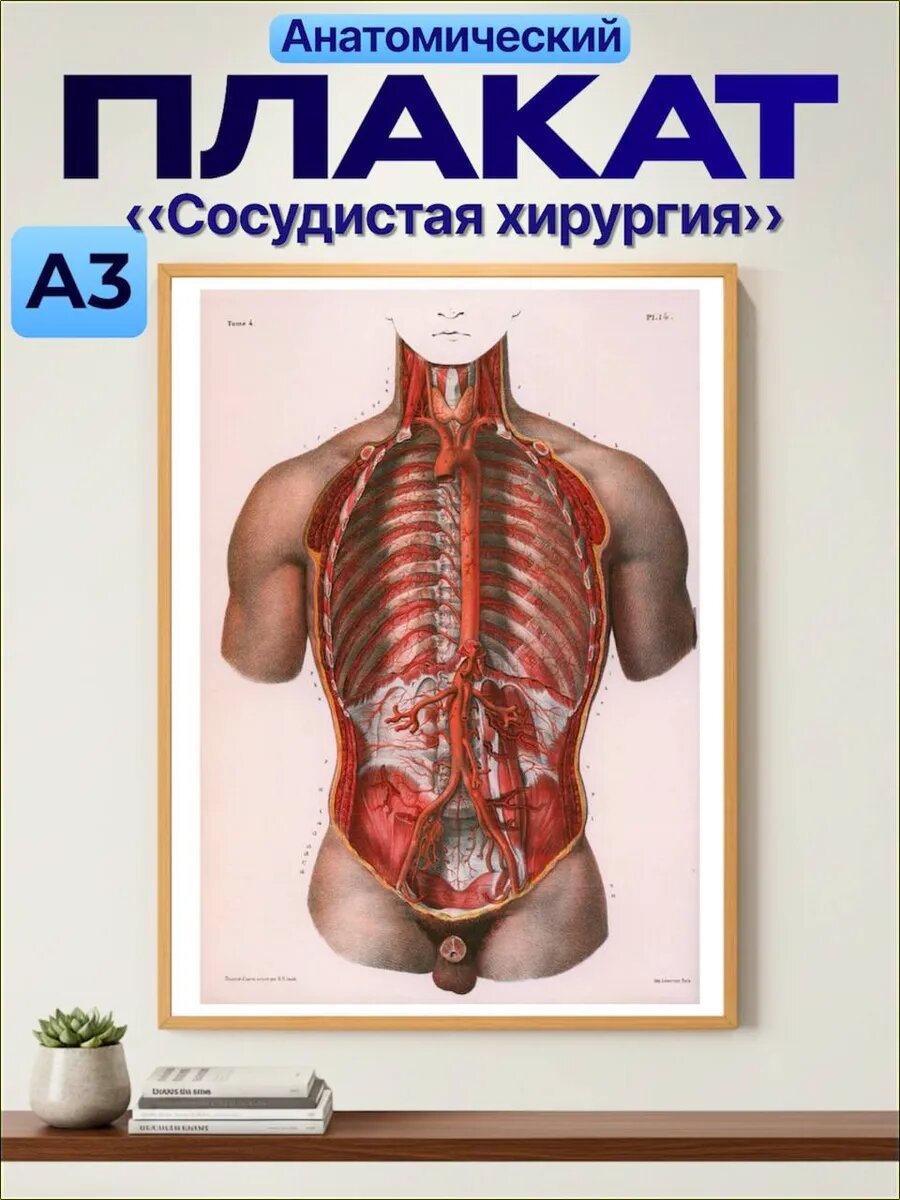 Постер медицинский, аорта, сосудистая хирургия, А3 анатомия, хирургия