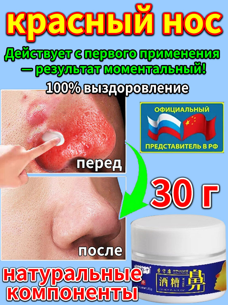 Крем от розацеа, купероза и красного носа покраснение уходит за 1 день! Чистая кожа с первого применения, натуральные компоненты