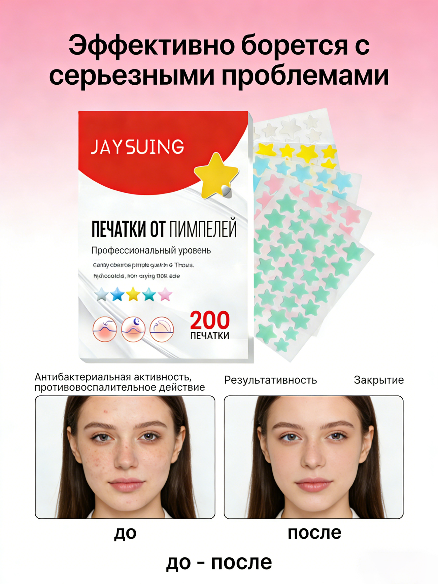 Патчи от прыщей гидроколлоидные / наклейки от прыщей в виде звездочек