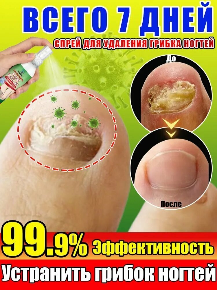 Спрей от грибка ногтей, для лечения грибка и онихолизиса, восстановления и роста / 90 мл
