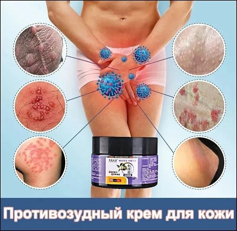 Успокаивающий крем-гель от зуда, воспаления и раздражения в интимных местах 30 г