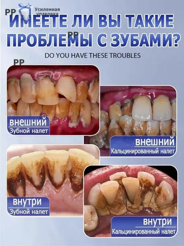 Мощная отбеливающая зубная паста, зубной камень и налет, укрепляет десны, ухаживает за полостью рта, для чувствительных зубов и десен 130 г