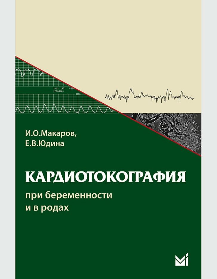 Кардиотокография при беременности и в родах