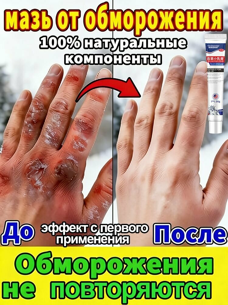 Мазь от обморожения для рук, ног, носа и ушей, восстановление после обморожения, быстрое заживление, устранение покраснений, зуда, трещин, быстрый эффект, 20 грамм