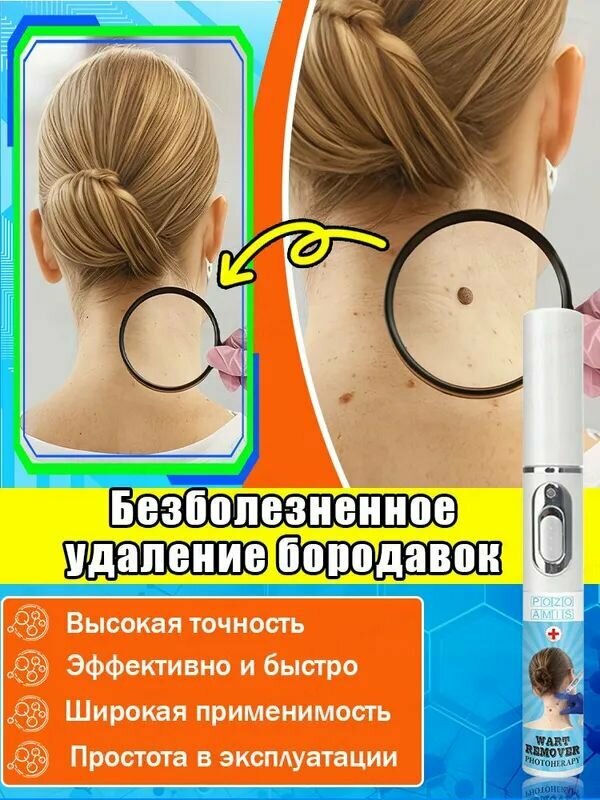 Лазерная указка для удаления бородавок быстро удаляет обычные, плоские, подошвенные бородавки, папилломы и т. д, безопасно и не вызывает раздражения, не оставляя шрамов.1 штука