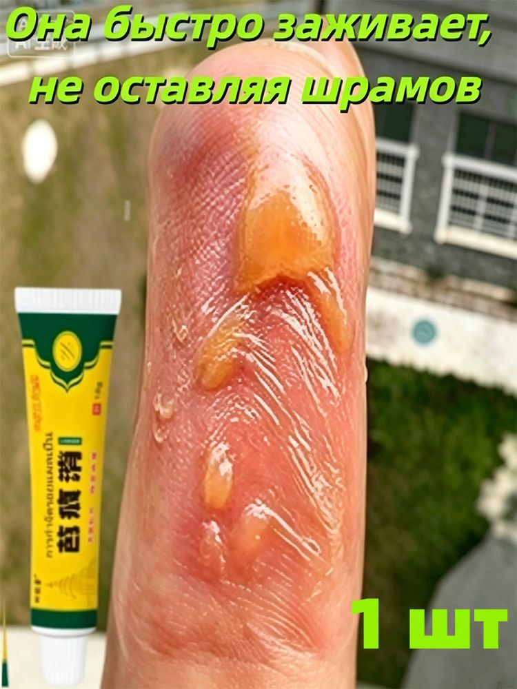 Гель от шрамов и рубцов / Мазь от рубцов, угревой сыпи, ожогов, 18 г