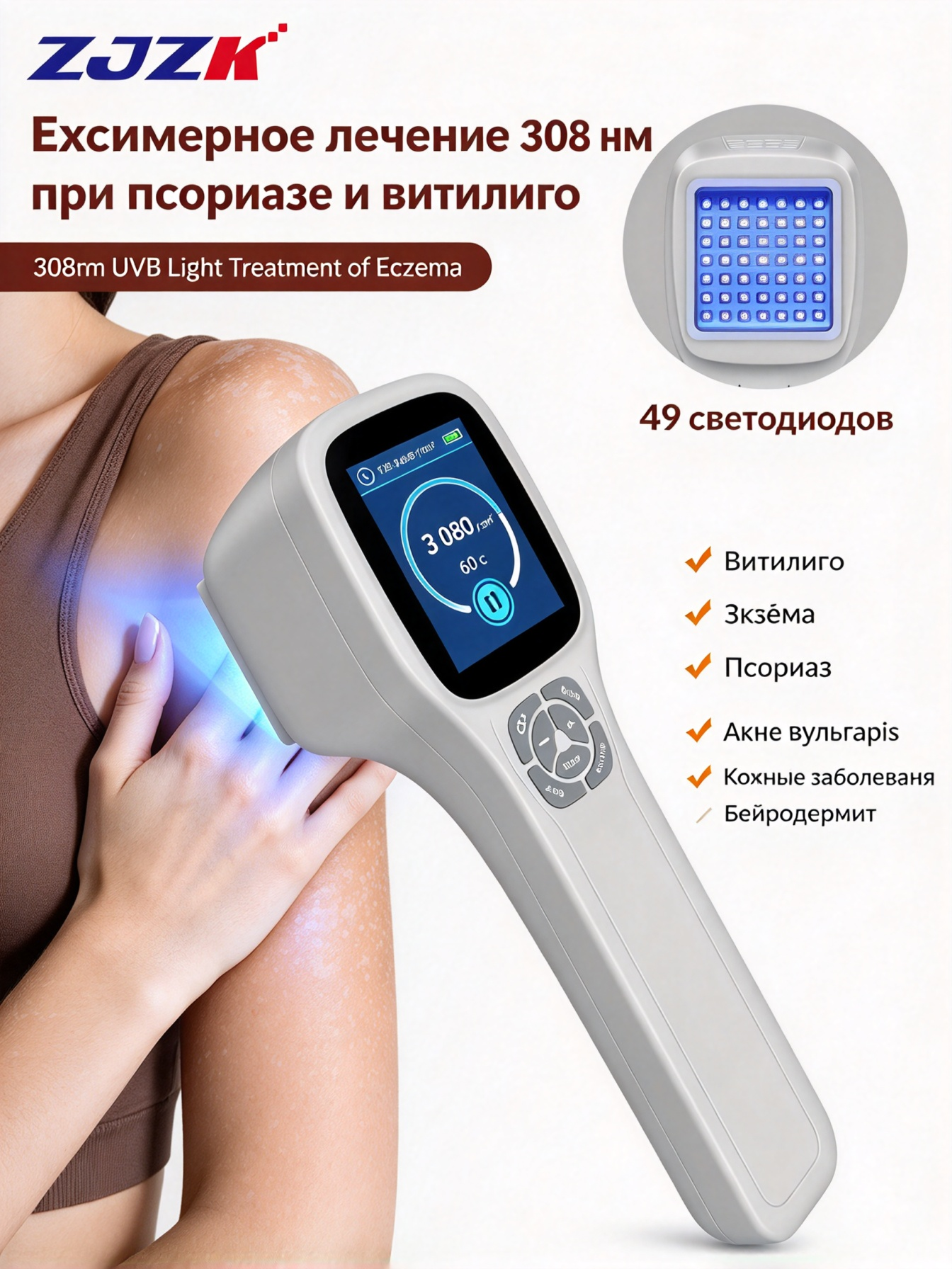 ZJZK Ультрафиолетовая светотерапия узкополосным светом от плоского лишая, убирает небольшие белые пятна на коже