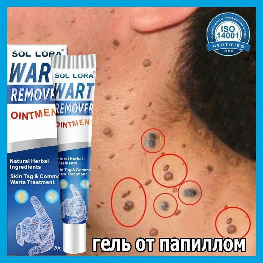 Гель от папилломы / Очищающее средство, крем бородавок, прыщей, для тела, рук, ног / 20 мл11