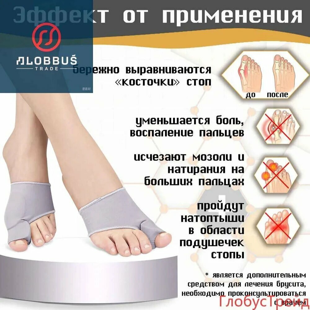 Корректор стопы — фото 1