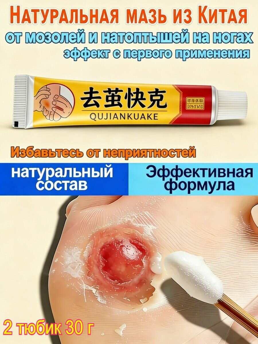 Крем для ног от сухих мозолей и натоптышей, размягчающий, 2 тюбик 30 г