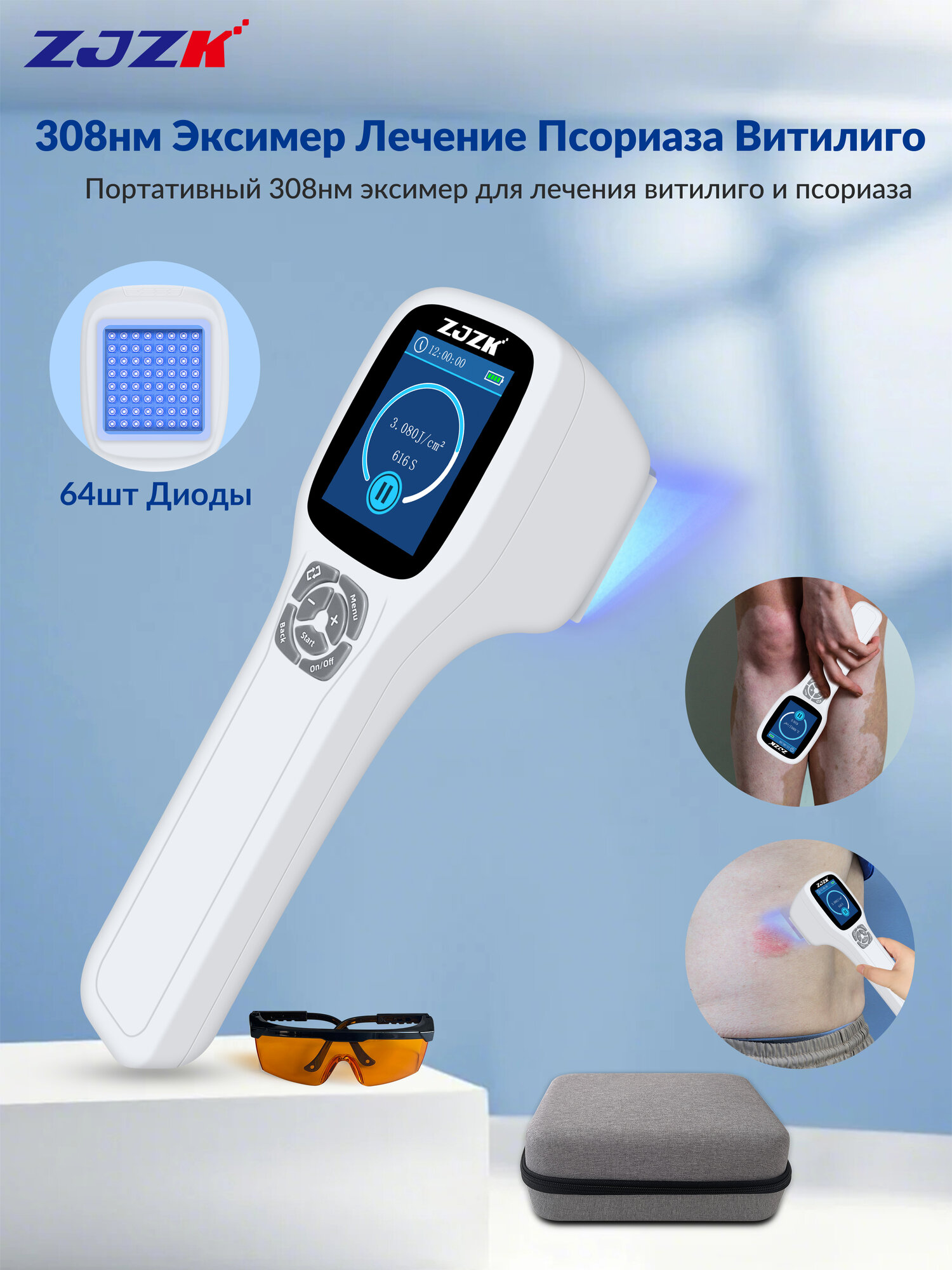 Лазер 308 нм для лечения витилиго и псориаза – Точечная УФB фототерапия для восстановления кожи