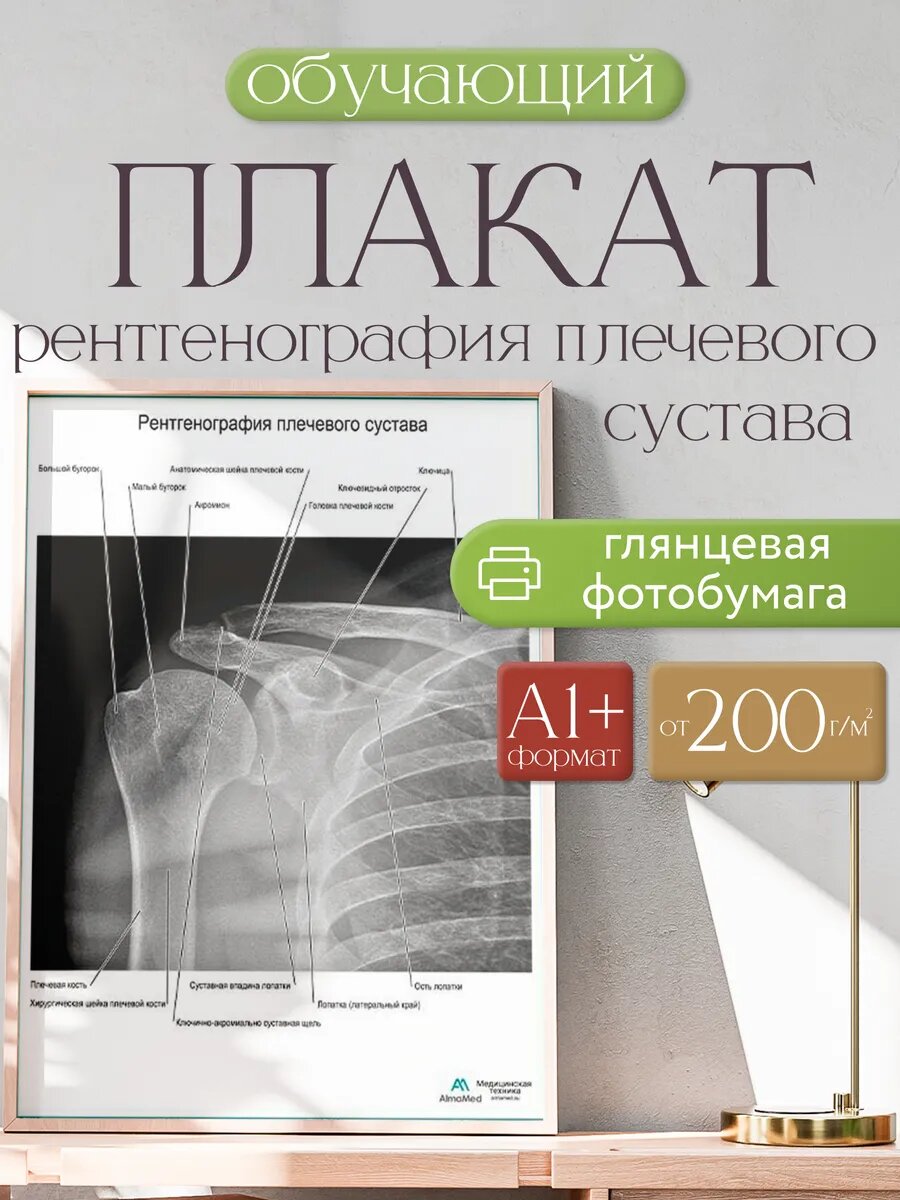 Рентгенография плечевого сустава плакат глянцевая фотобумага от 200 г/кв. м, размер A1+