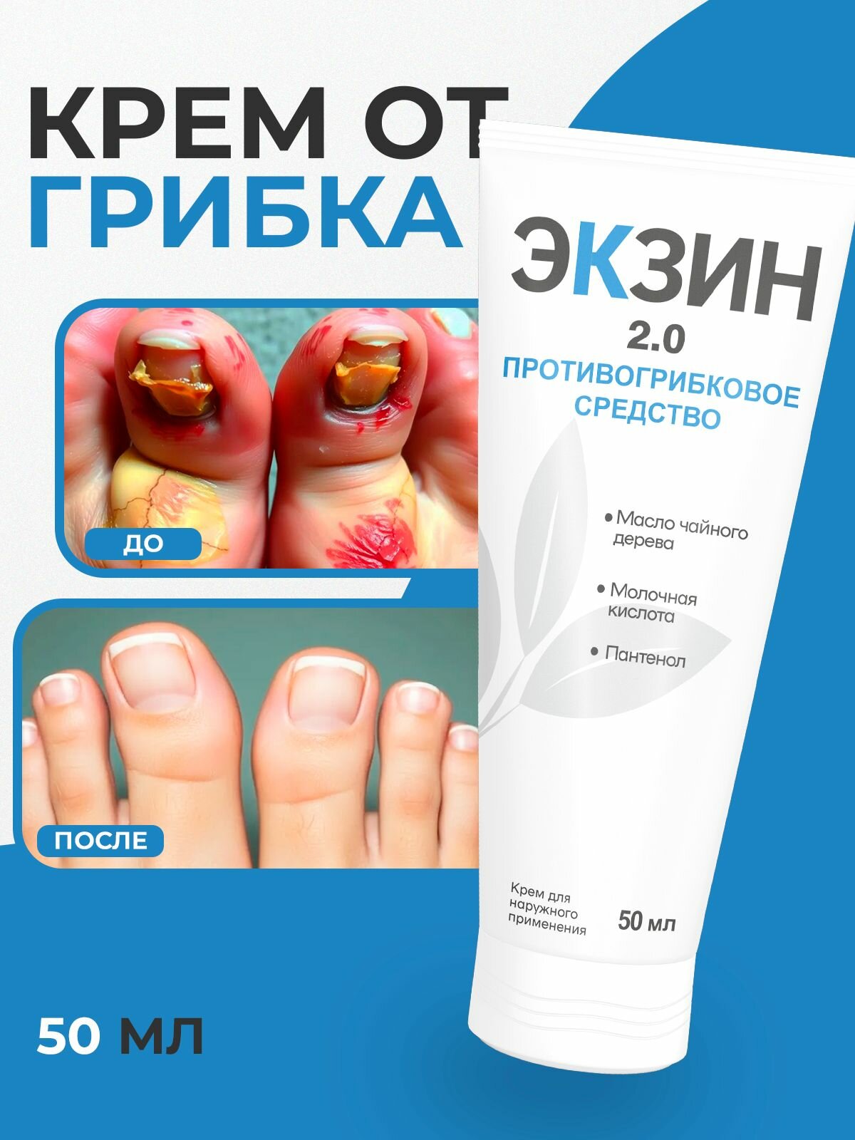 Экзин 2.0: крем от грибка ногтей и стопы, от зуда и запаха, для трещин и восстановления ногтей