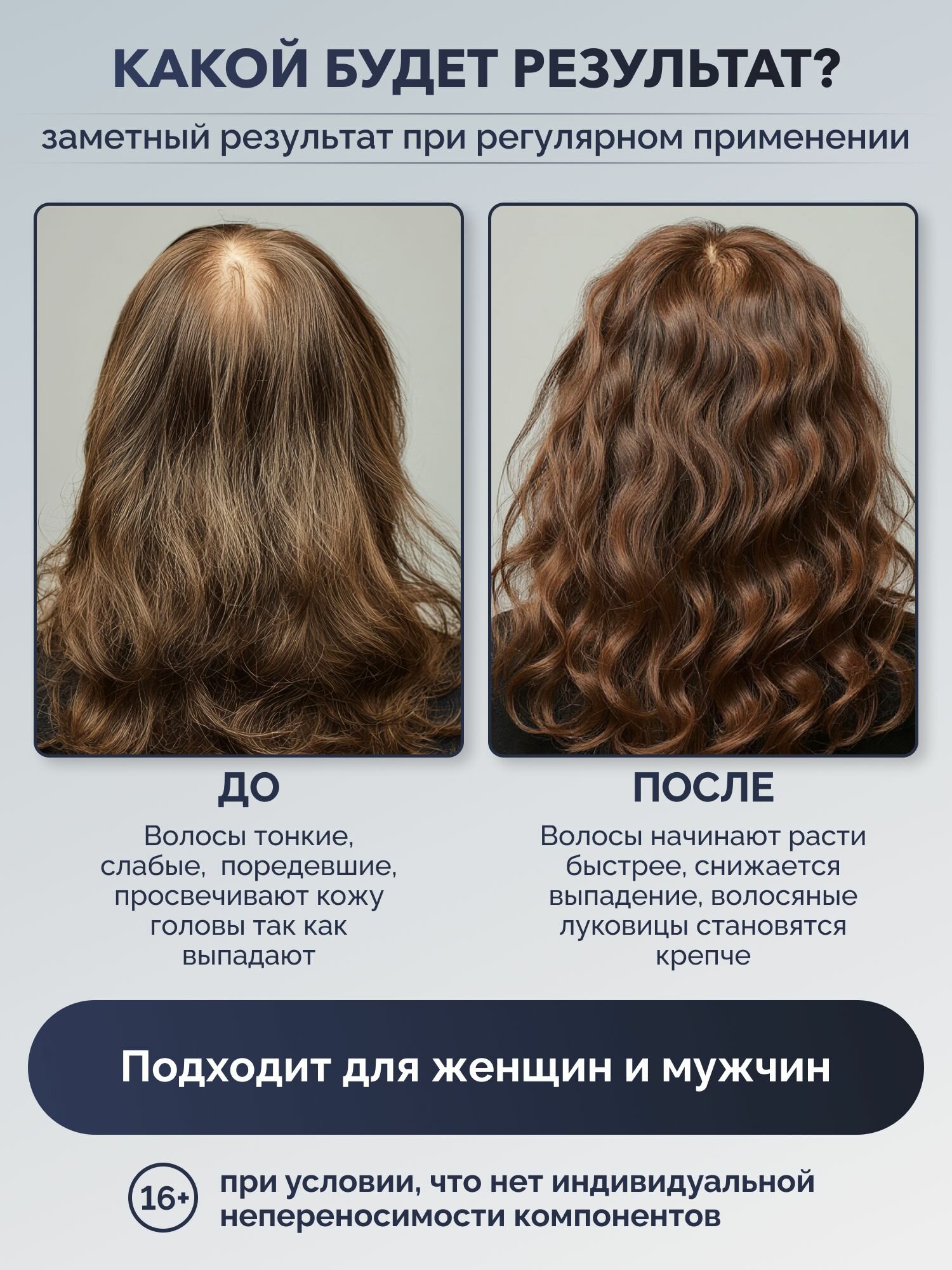 Сыворотка для роста волос с розмарином, от выпадения волос, Francua, 100 мл