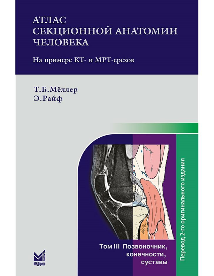 Атлас секционной анатомии. т.3. Позвоночник, конечности, суставы