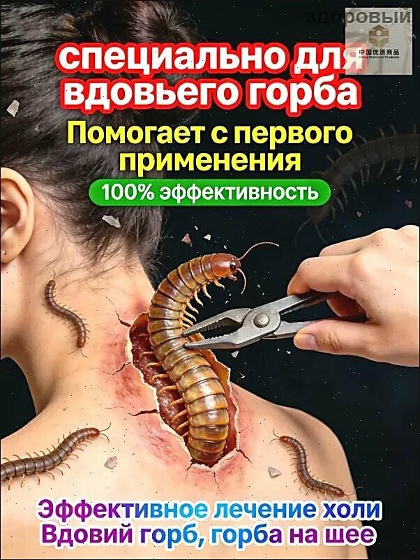 Эксклюзивная мазь от шейного остеохондроза и вдовьего горба, созданная на 100 из натуральных, сделано в Китае