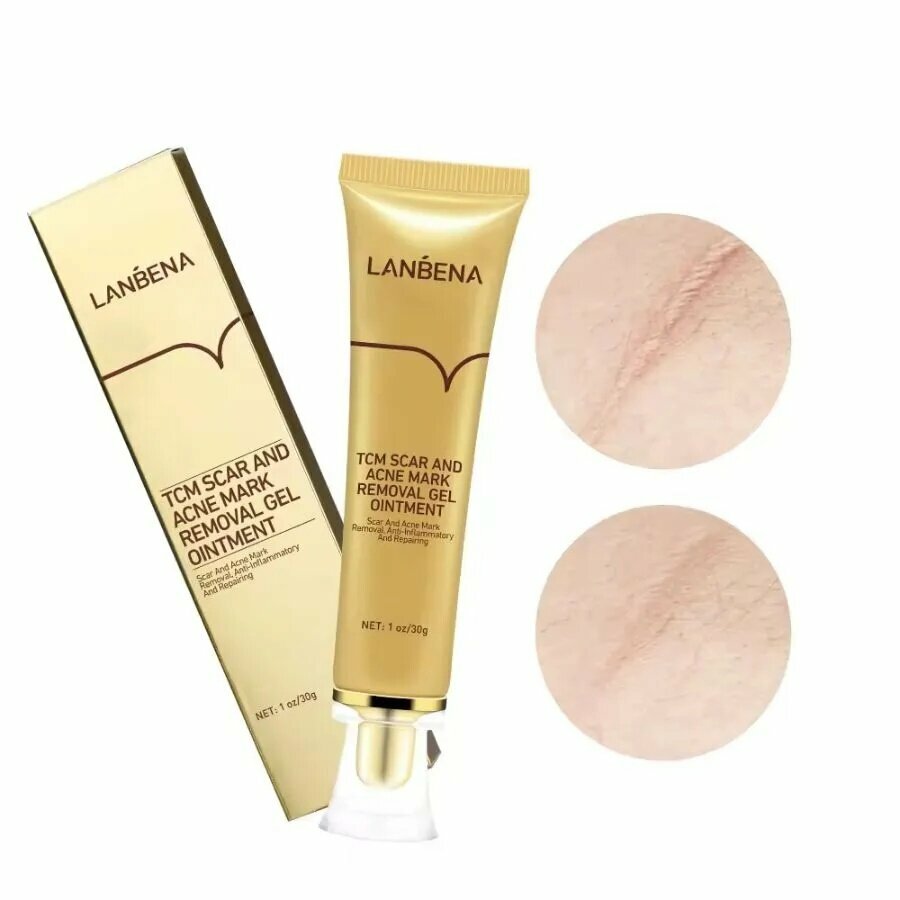 Средство от растяжек