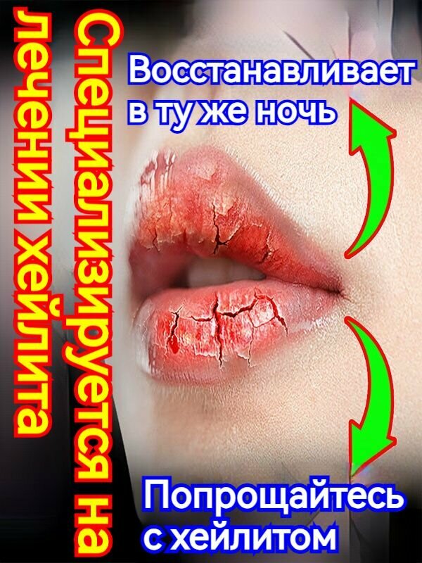 Крем от герпеса и хейлита Sumifun, против трещин и сухости на губах