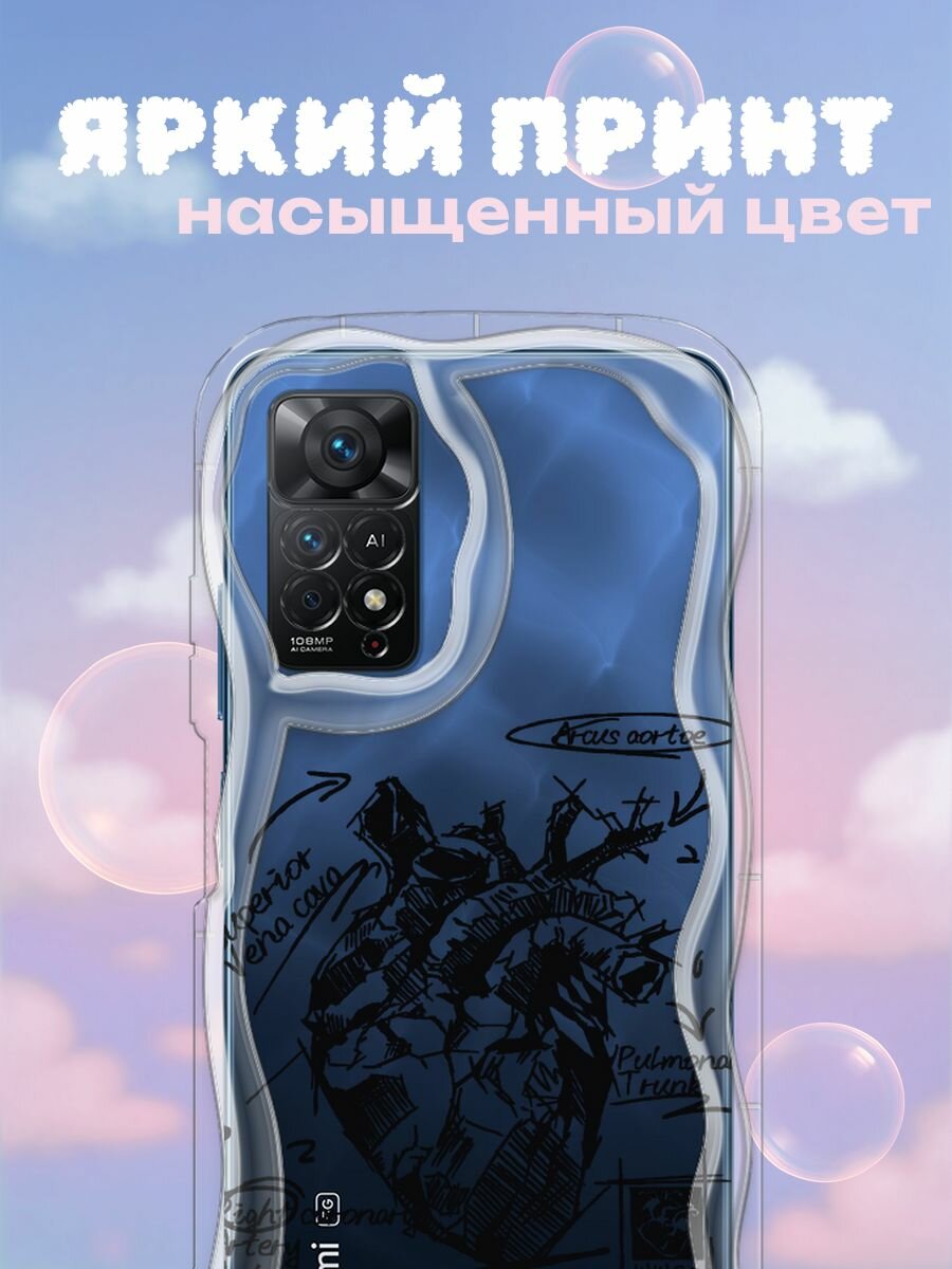 Чехол на Xiaomi Redmi Note 11 Pro/11 Pro 5G/11E Pro/12 Pro 4G / Редми Нот 11 Про с принтом "Анатомическое сердце 2" — фото 1