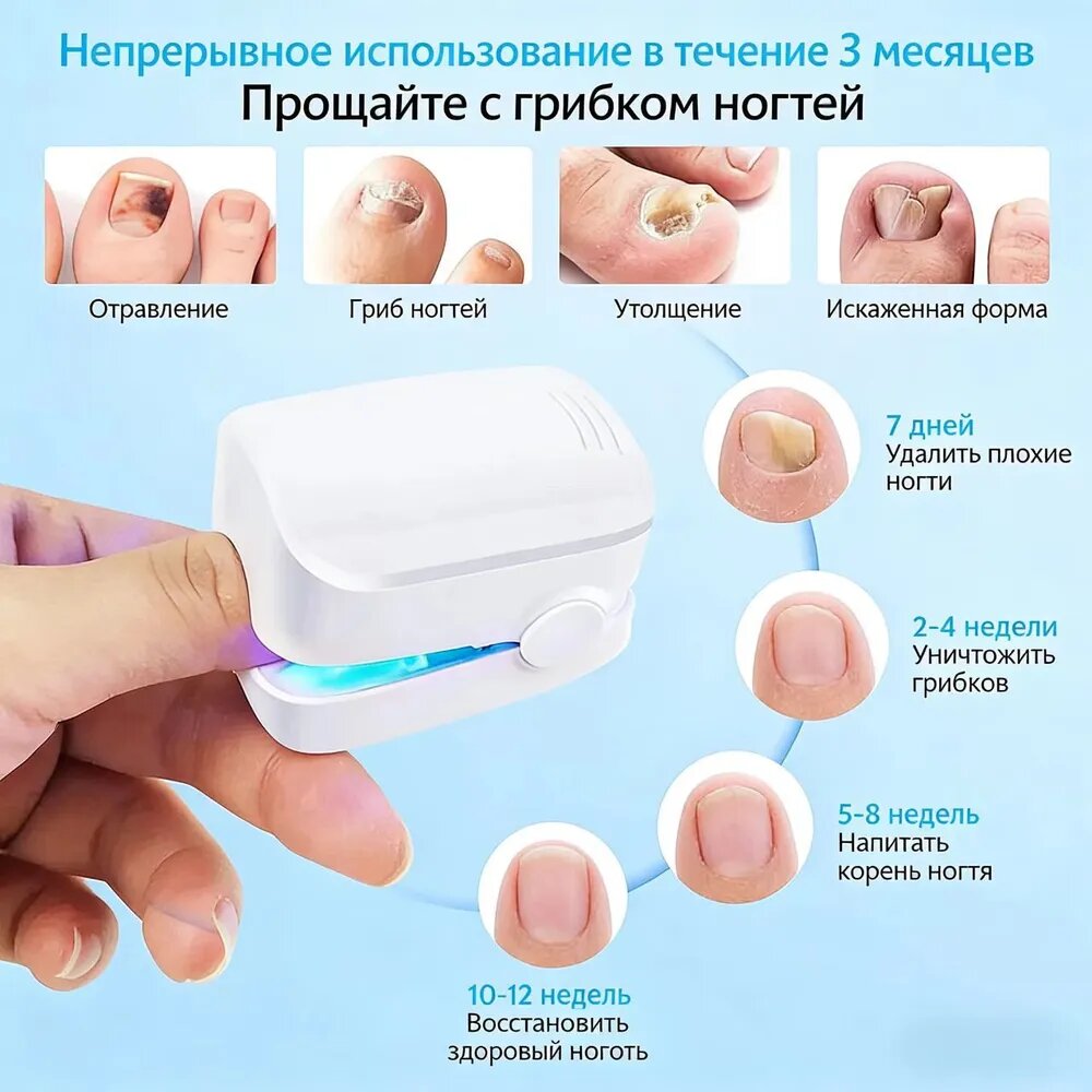 Инновационный бестселлер для лазерной терапии грибка ногтей