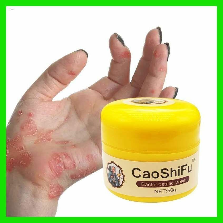 CAOSHIFU Антибактериальный крем для кожи, 50 г, большая емкость. Мазь от псориаза, дерматита, зуда кожи и экземы, для проблемной кожи на теле.