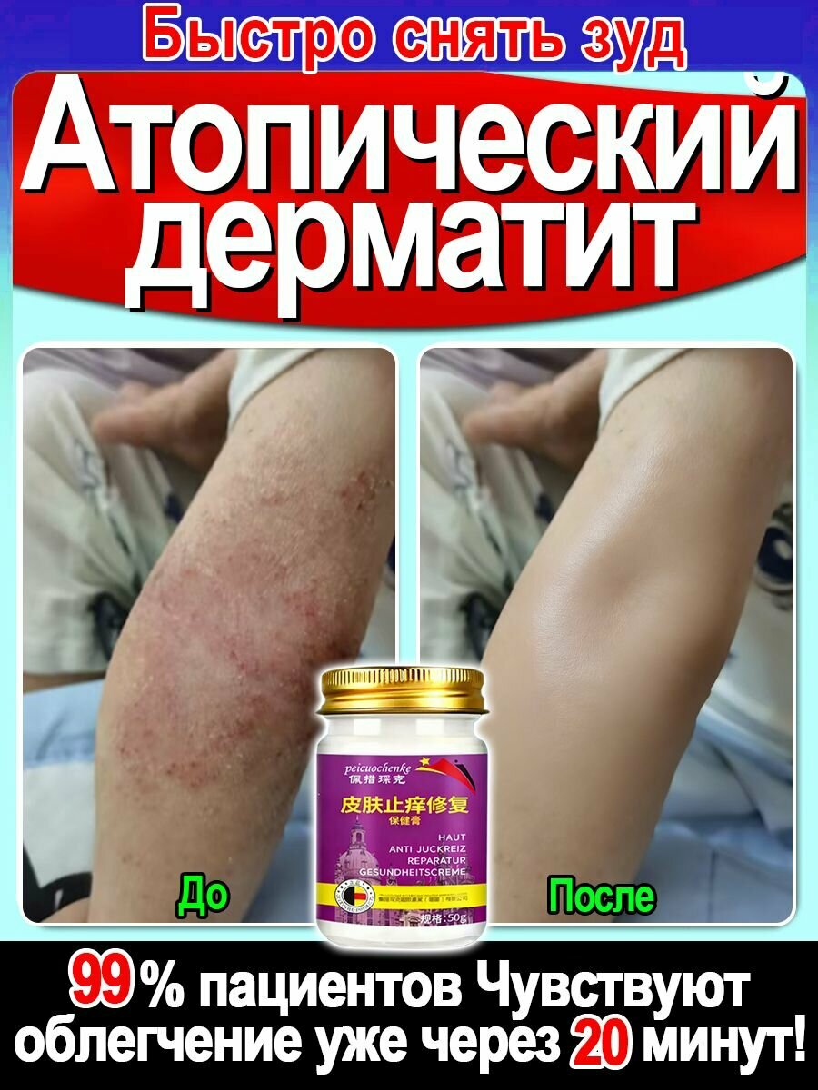 Лосьон крем увлажняющий для тела для атопичной и сухой кожи 50ml